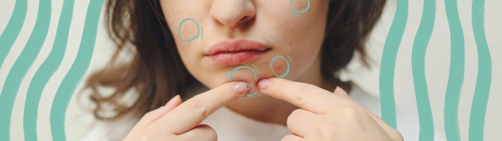 Cómo quitar granos enquistados | Blog de Arenal